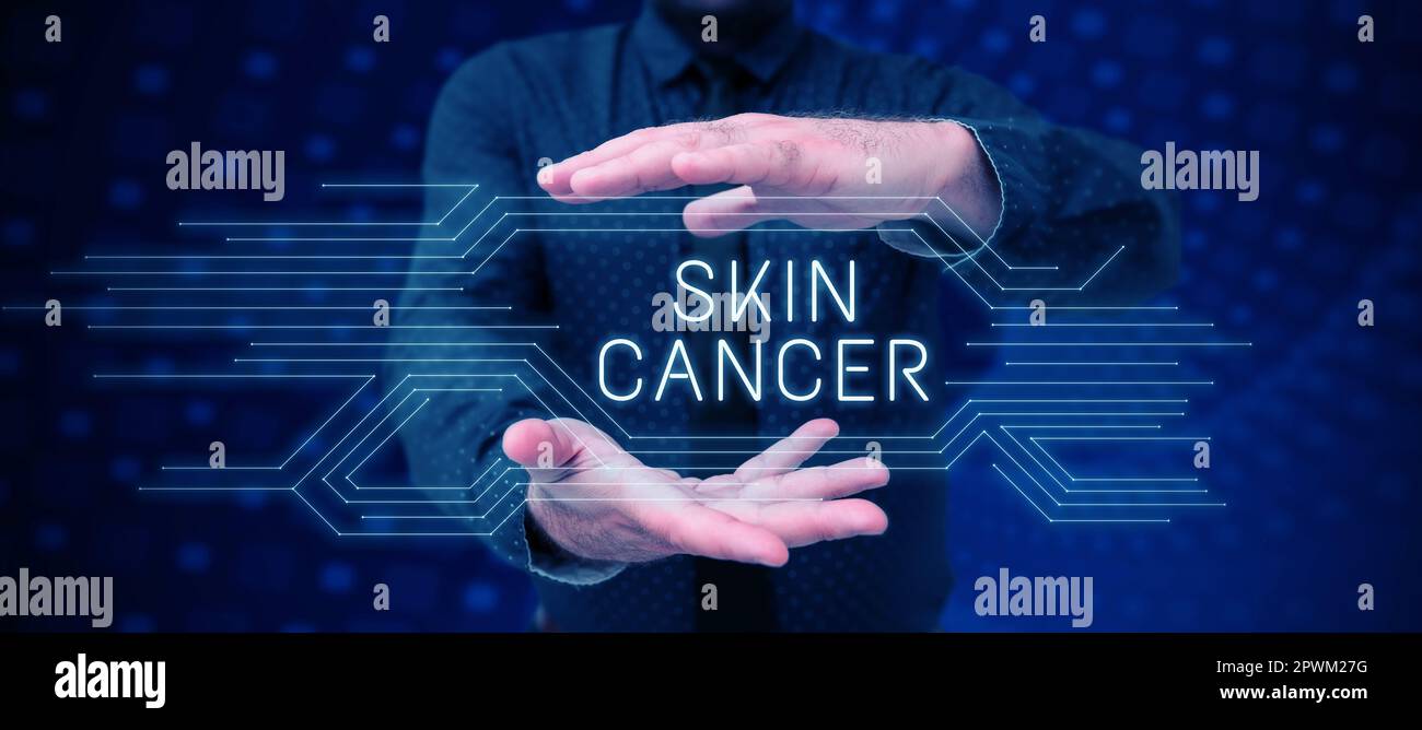 Text sign showing Skin Cancer, Conceptual photo uncontrolled growth of ...
