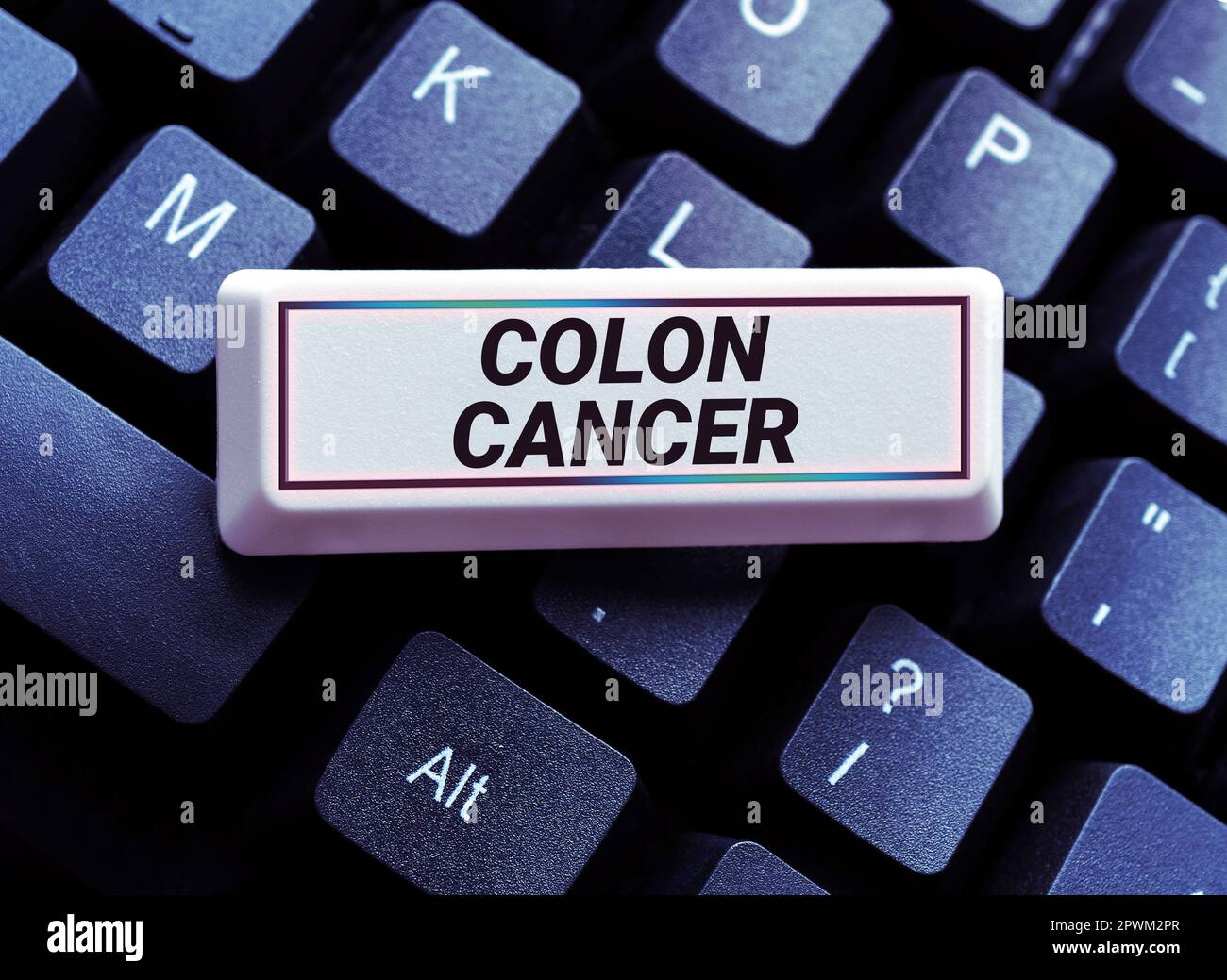 Writing displaying text Colon Cancer, Business concept Cancer that ...