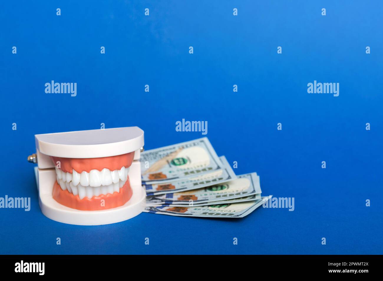 Closeup model of a human jaw with white teeth and dollar bill ...