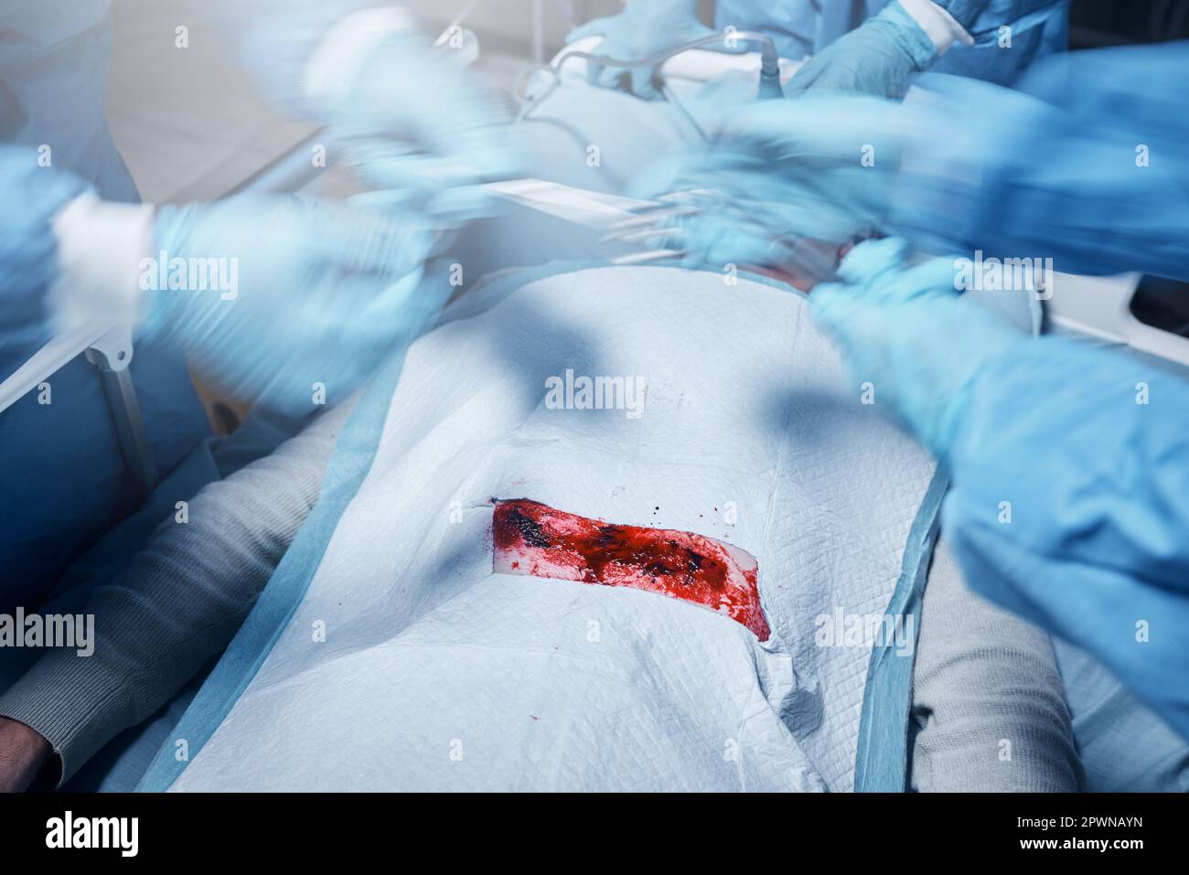 Hands, blood and operation with a team of doctors at work during ...