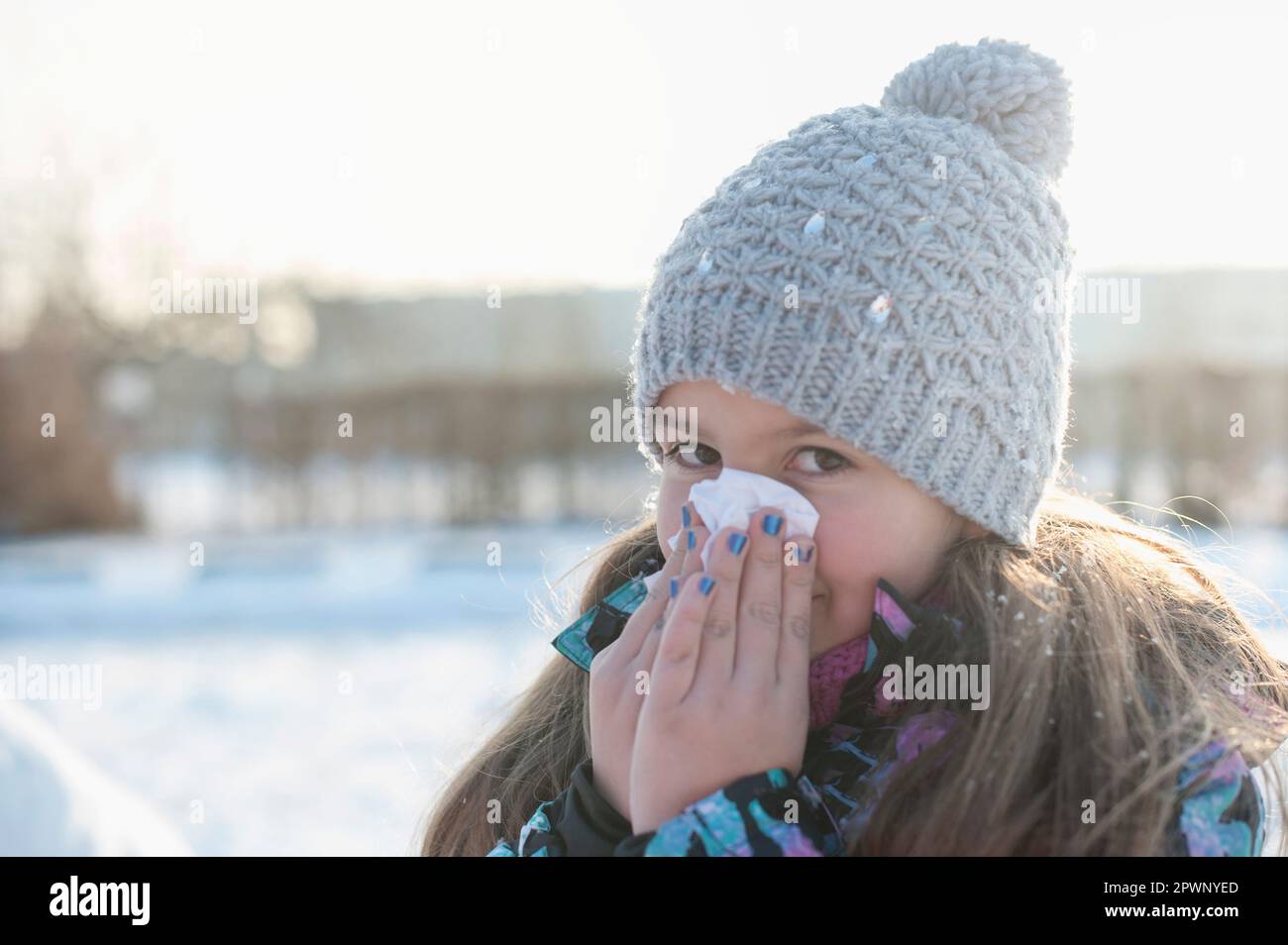 Portrait of girl sneezing in winter Stock Photo - Alamy