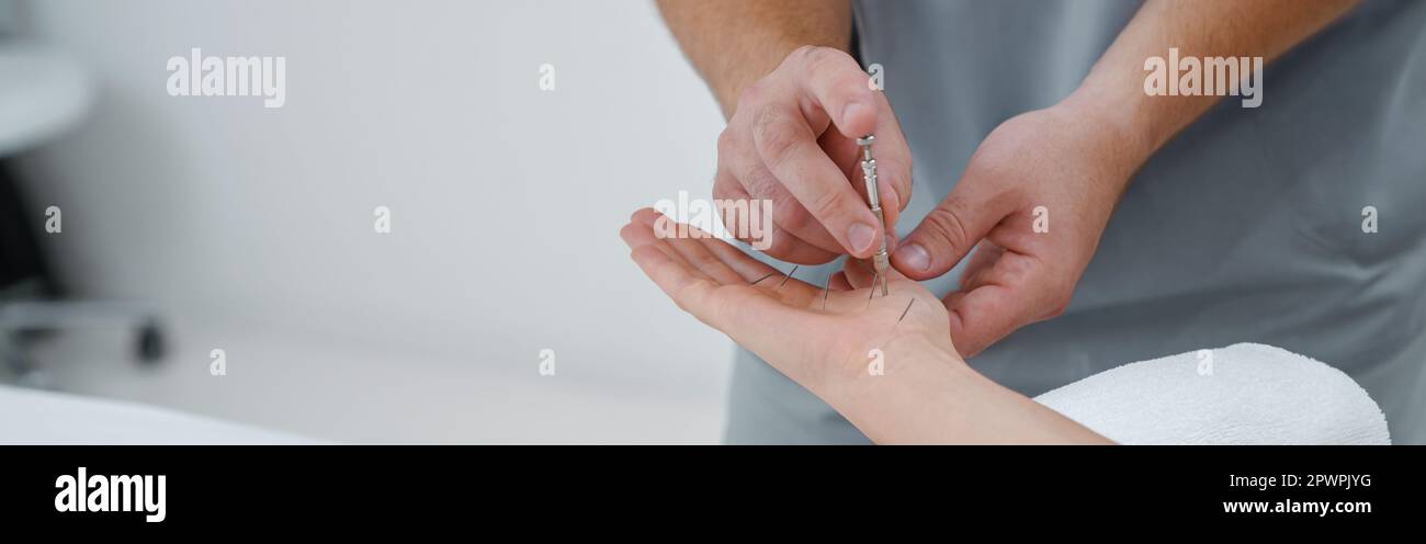 Doctor's hand perform professional acupuncture treatment in beauty spa ...