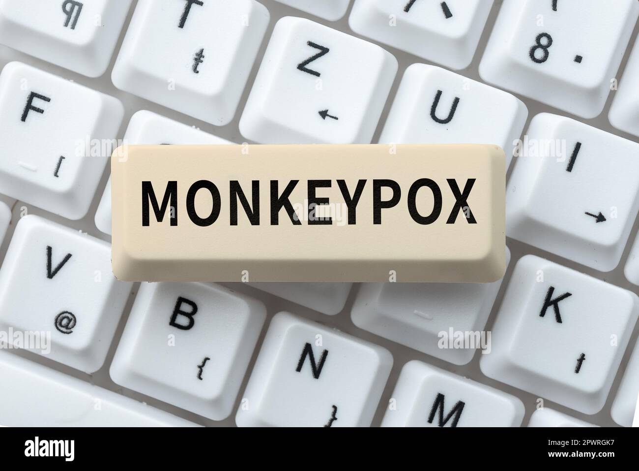 Hand writing sign Monkeypox, Concept meaning poxvirus of Africa caused ...