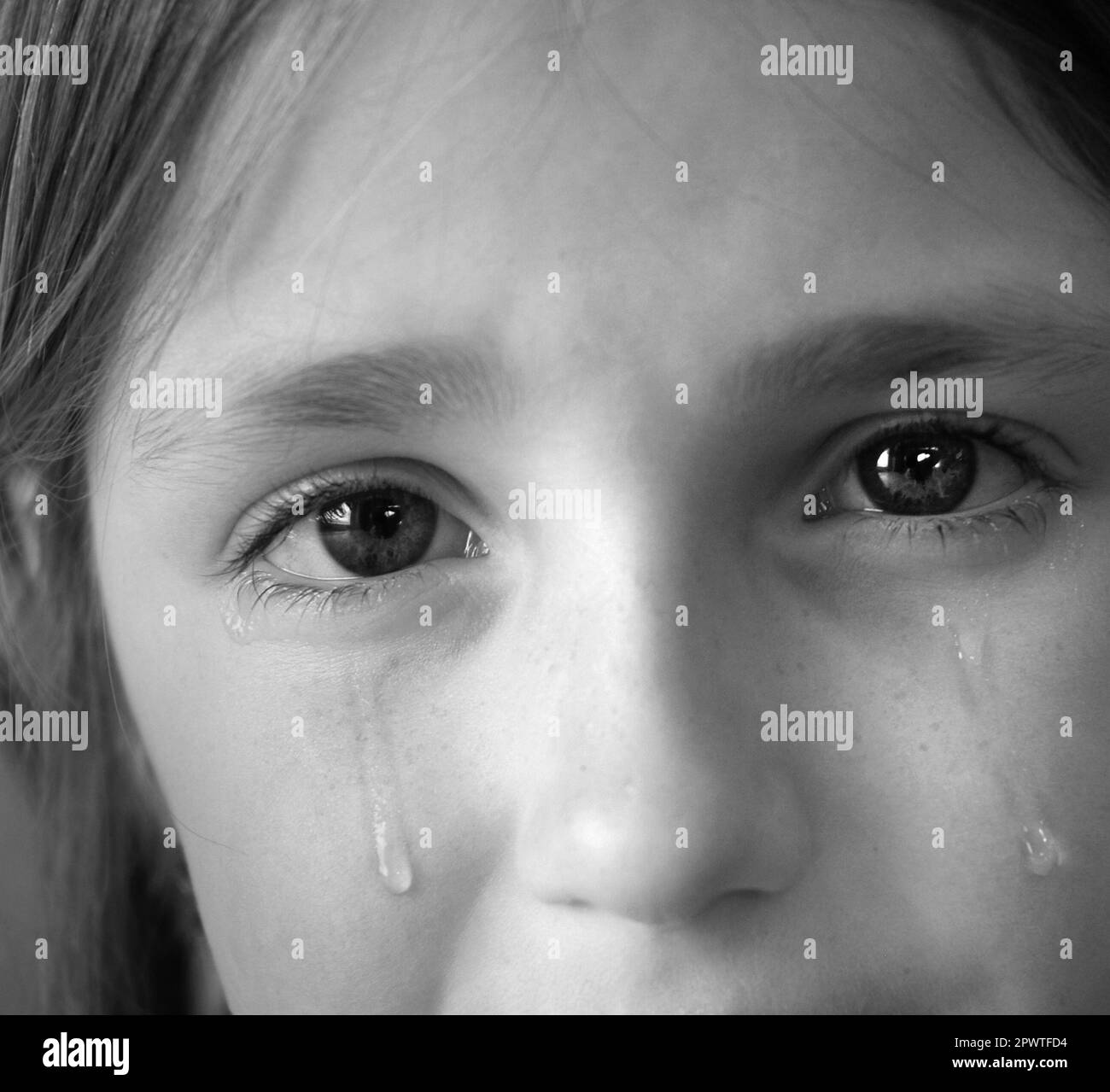 Girl crying with tears on her face of cheek rolling down sad and upset ...