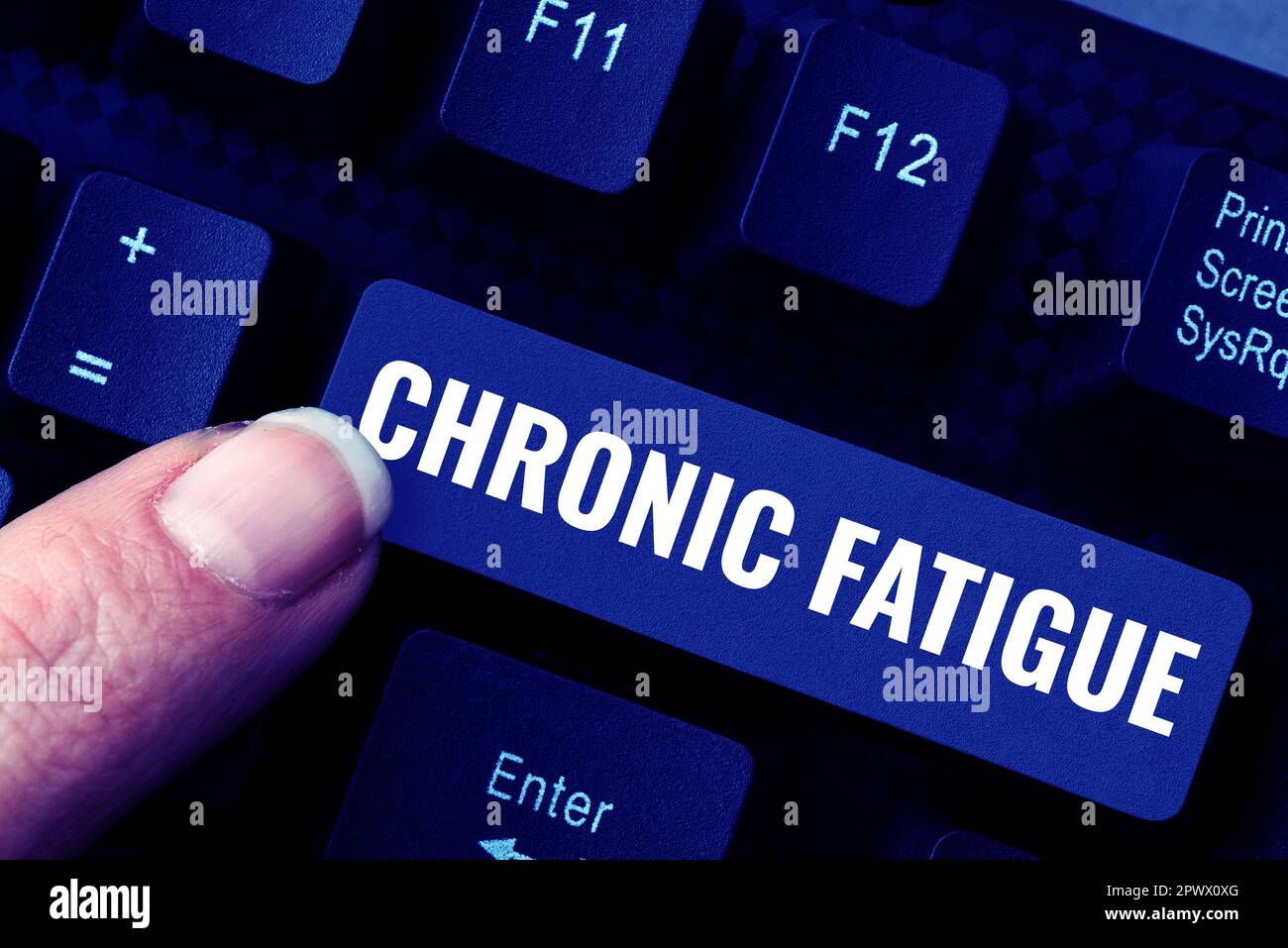 Text sign showing Chronic Fatigue, Business approach A disease or ...