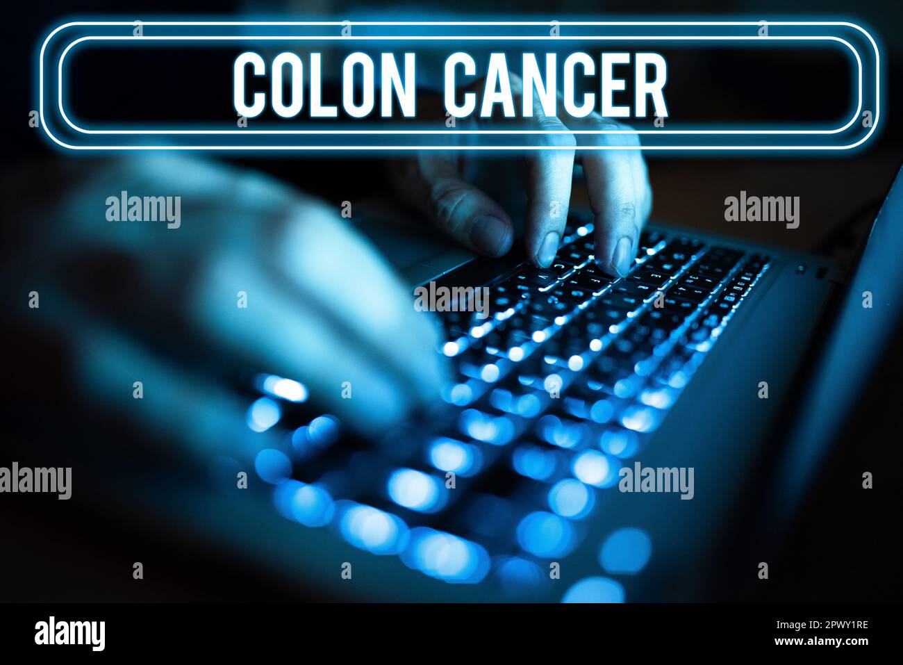 Text sign showing Colon Cancer, Business approach Cancer that forms in ...