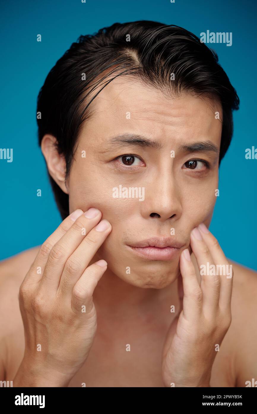 Face of young man sad after noticing skin imperfections on skin Stock ...