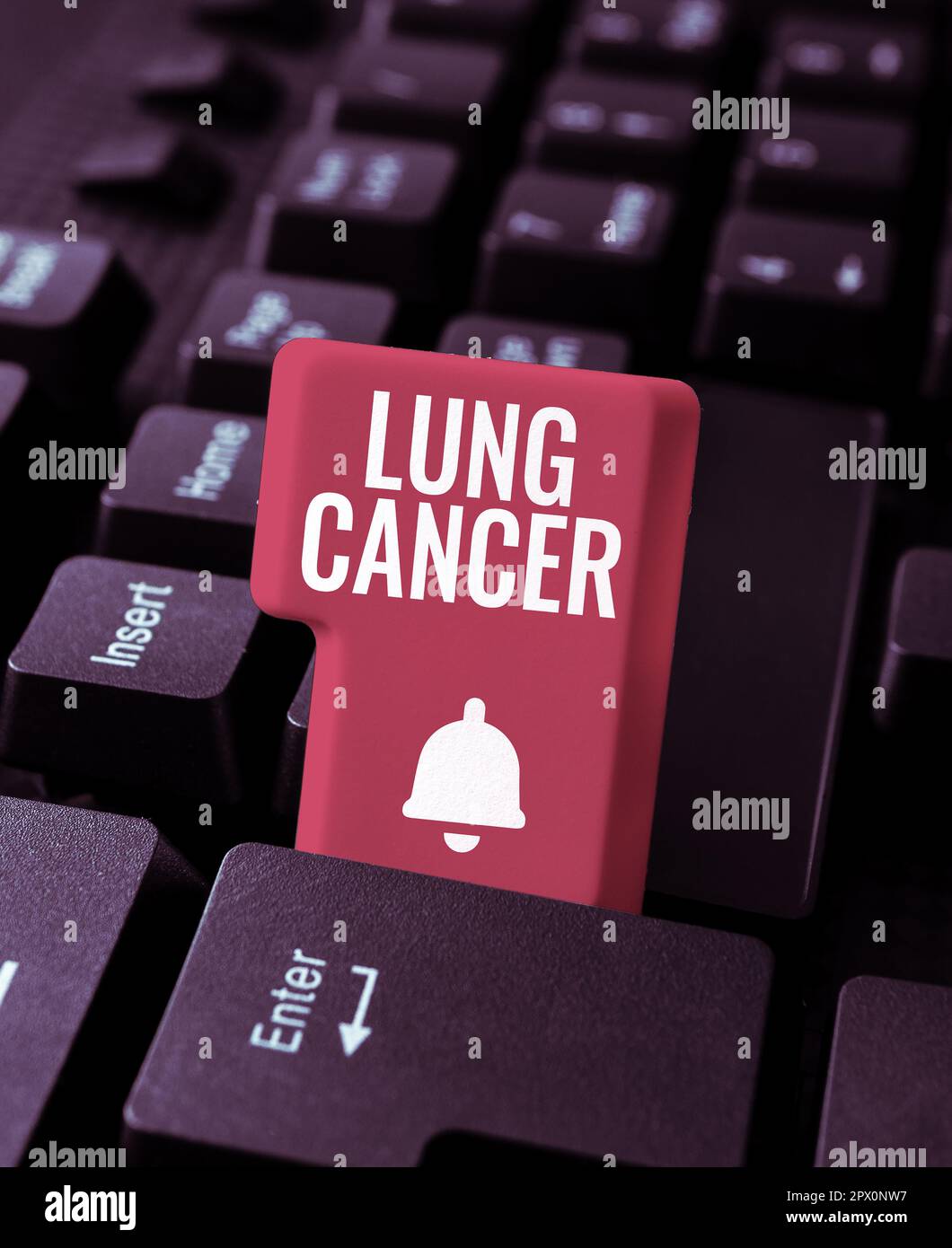 Handwriting text Lung Cancer, Conceptual photo Uncontrolled growth of ...