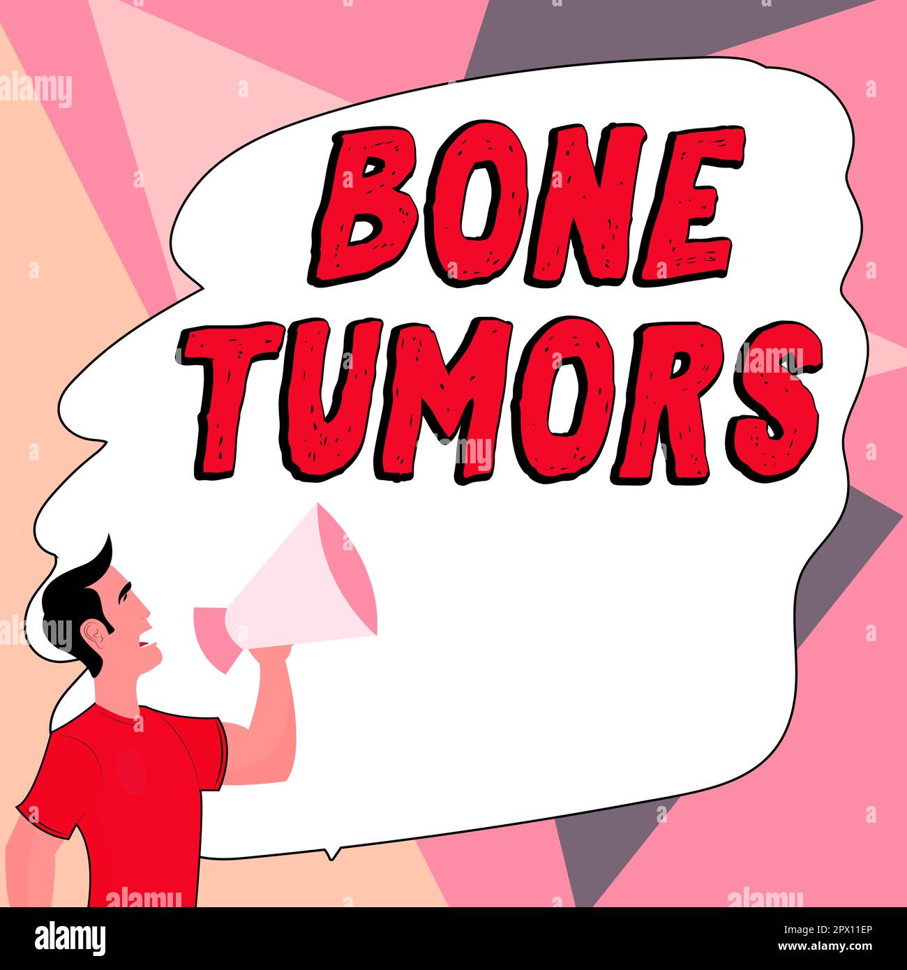 Writing displaying text Bone Tumors, Business approach can be either ...