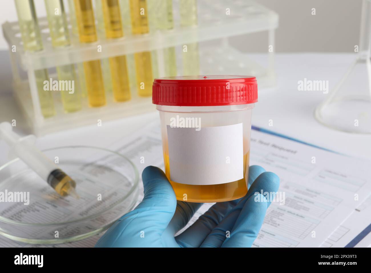 Nurse holding container with urine sample for analysis at table ...