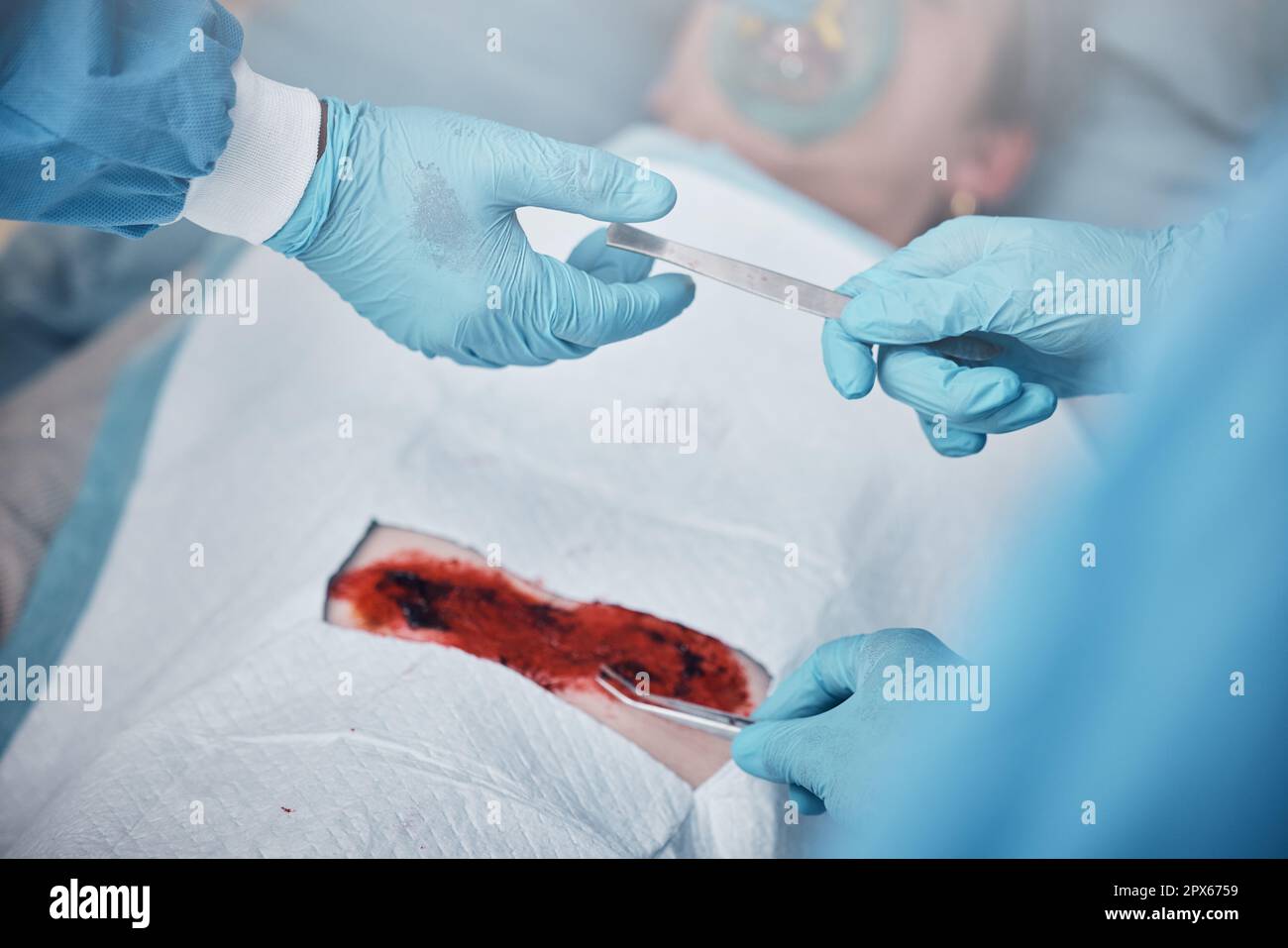 Hands, blood and operation with a team of doctors at work during ...