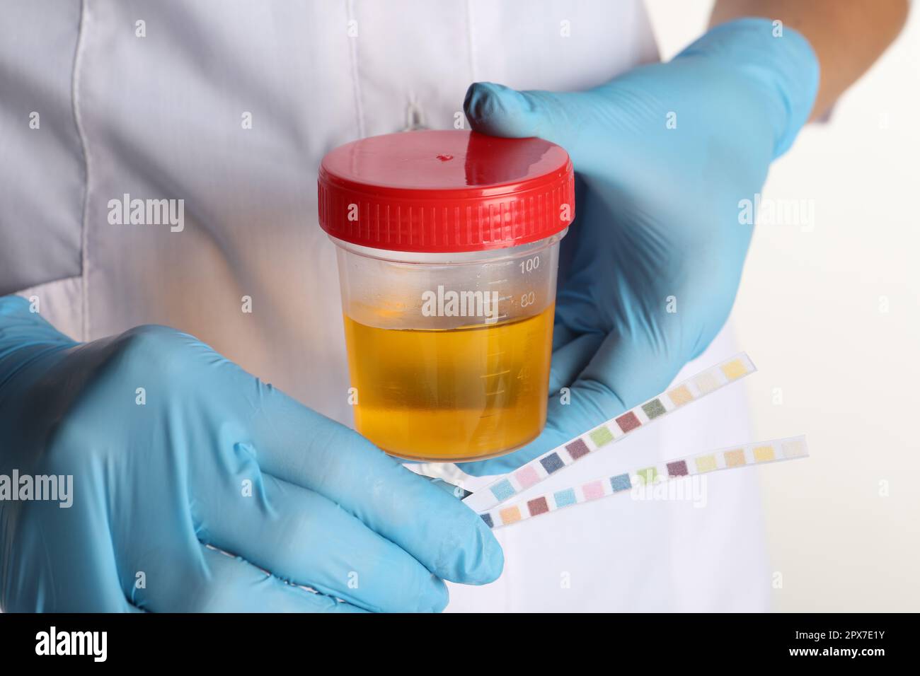 Nurse holding test strips and container with urine sample for analysis ...