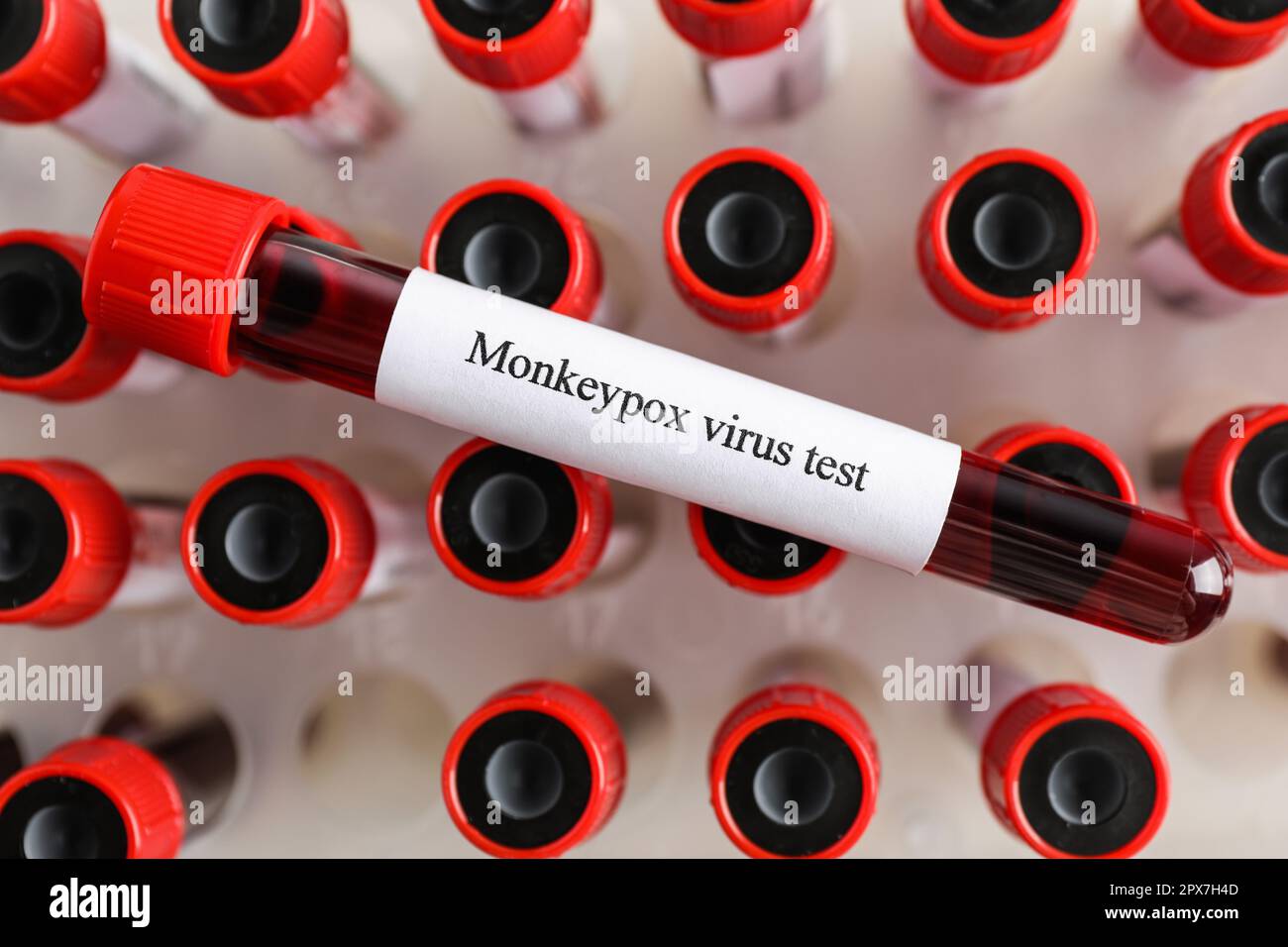 Monkeypox virus test. One sample tube with blood on others, top view ...