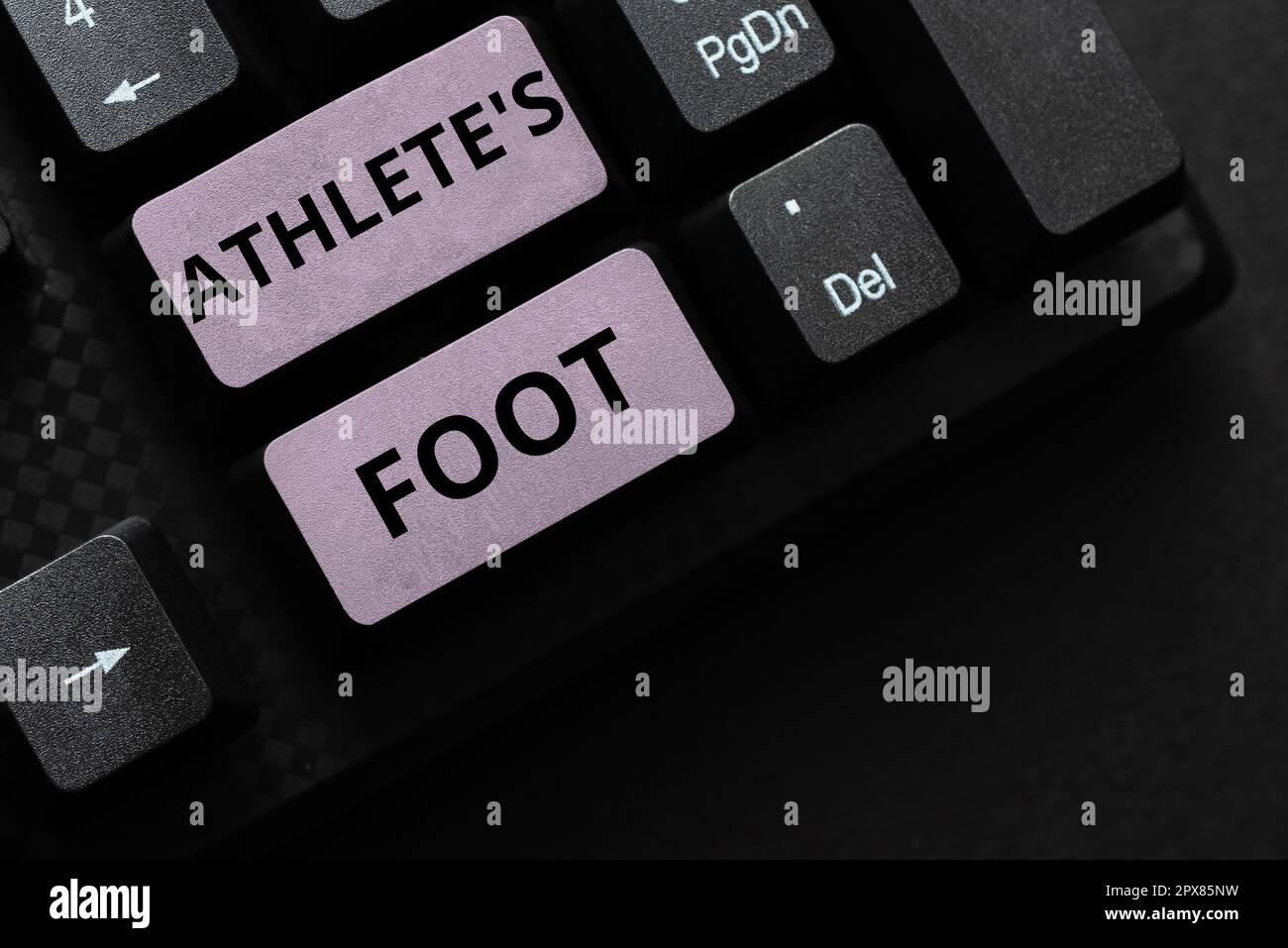 Text showing inspiration Athlete's Foot, Business showcase a fungus ...