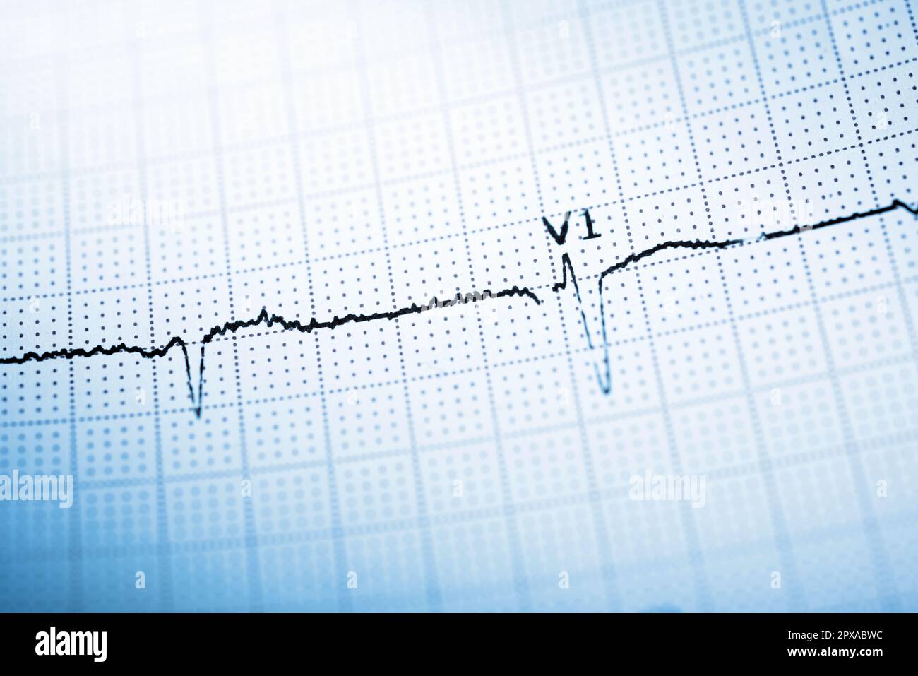 Electrocardiogram showing the pulse of the human heart Stock Photo - Alamy