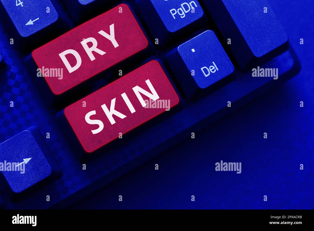 Hand writing sign Dry Skin, Business showcase uncomfortable condition ...