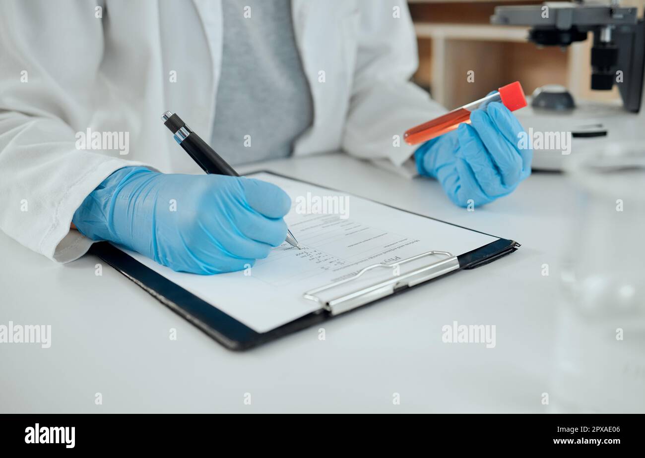 Getting closer to reaching my goal. a scientist holding a sample while ...