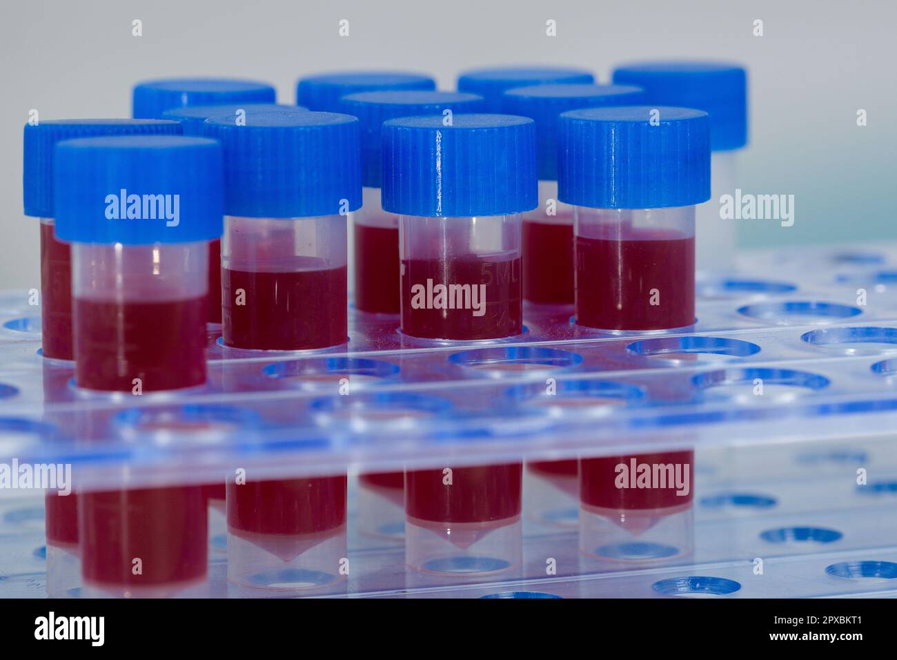 Diagnostic lab rack hi-res stock photography and images - Alamy