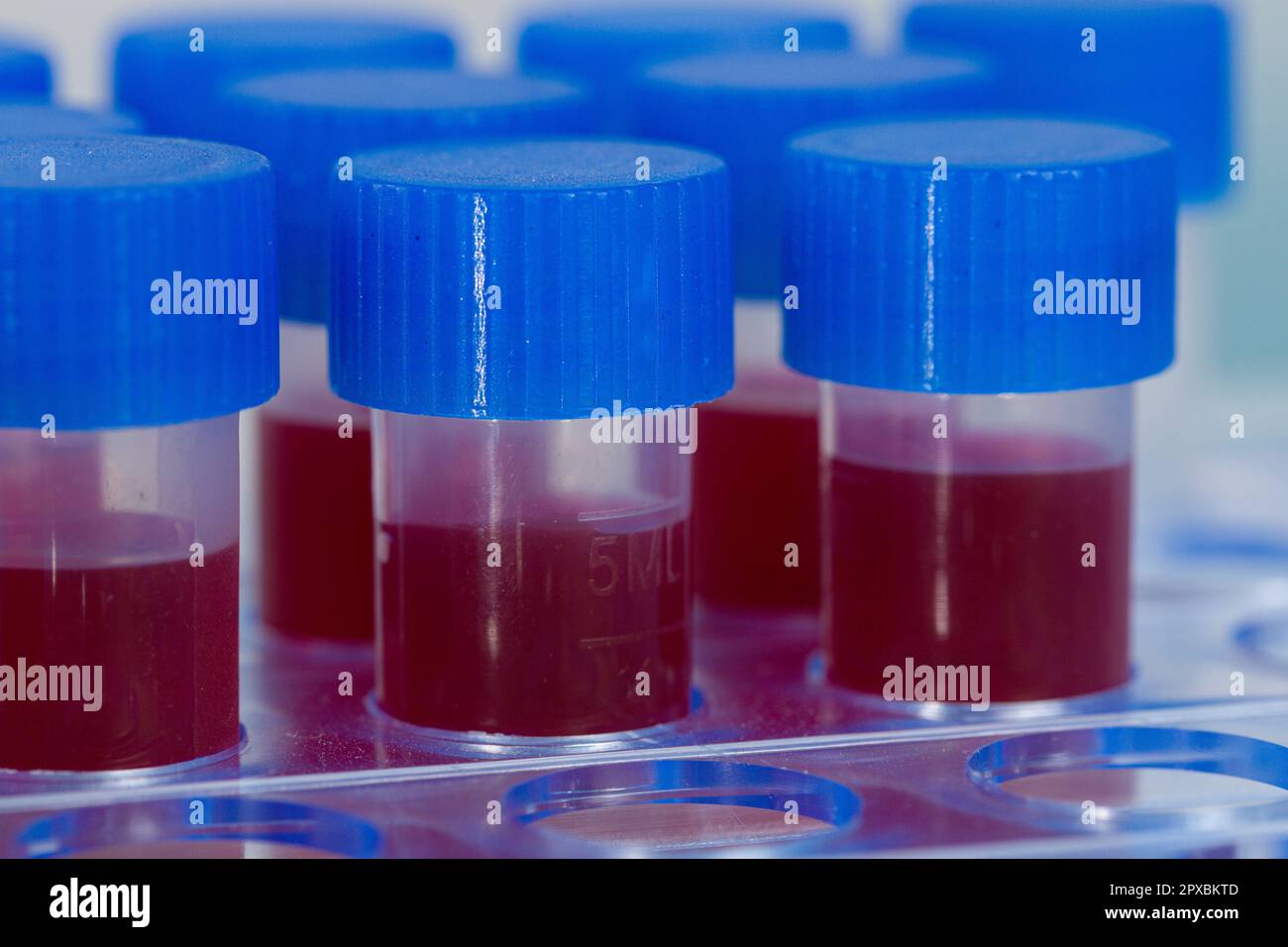 Rack blood hi-res stock photography and images - Alamy
