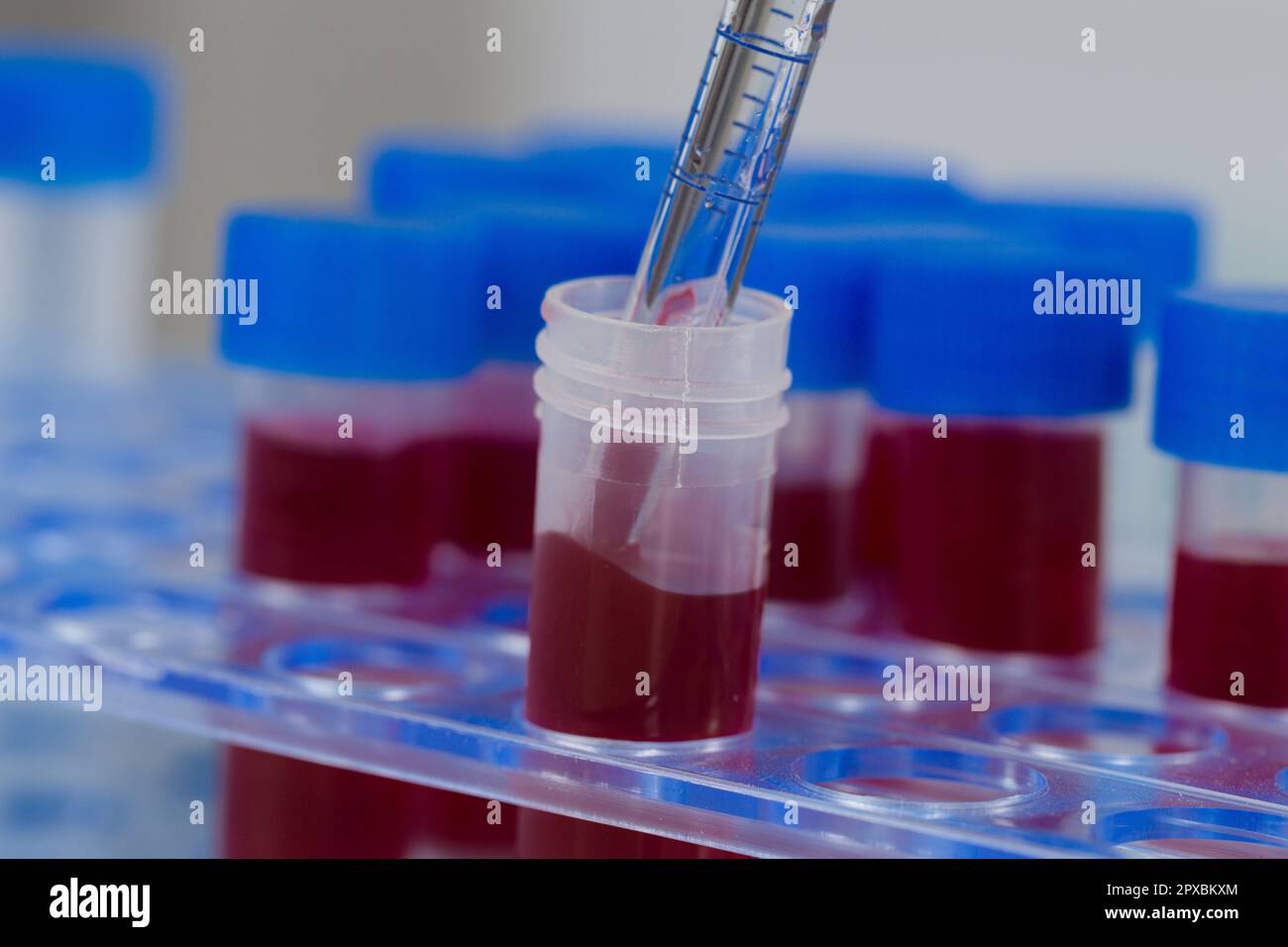 handling blood in a laboratory with a pipet Stock Photo - Alamy