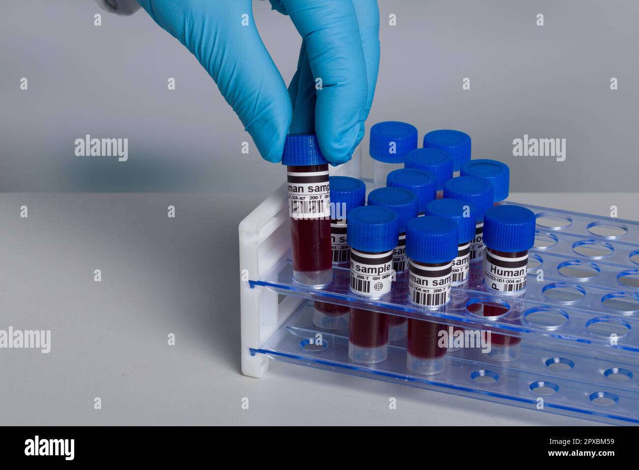 Laboratory tubes blood virus close hi-res stock photography and images ...