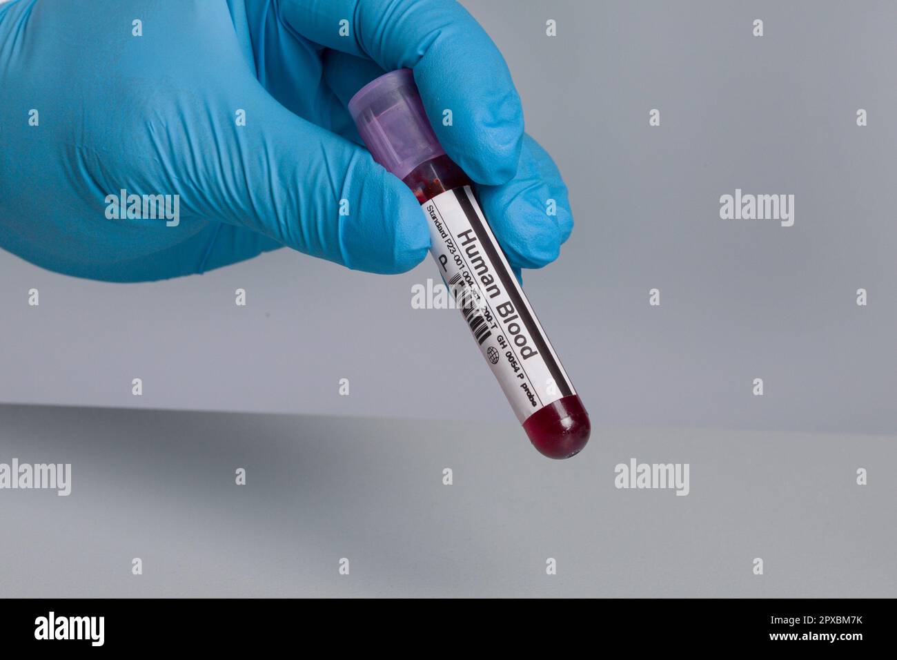 hand in medical gloves is hanling a blood test tube Stock Photo - Alamy