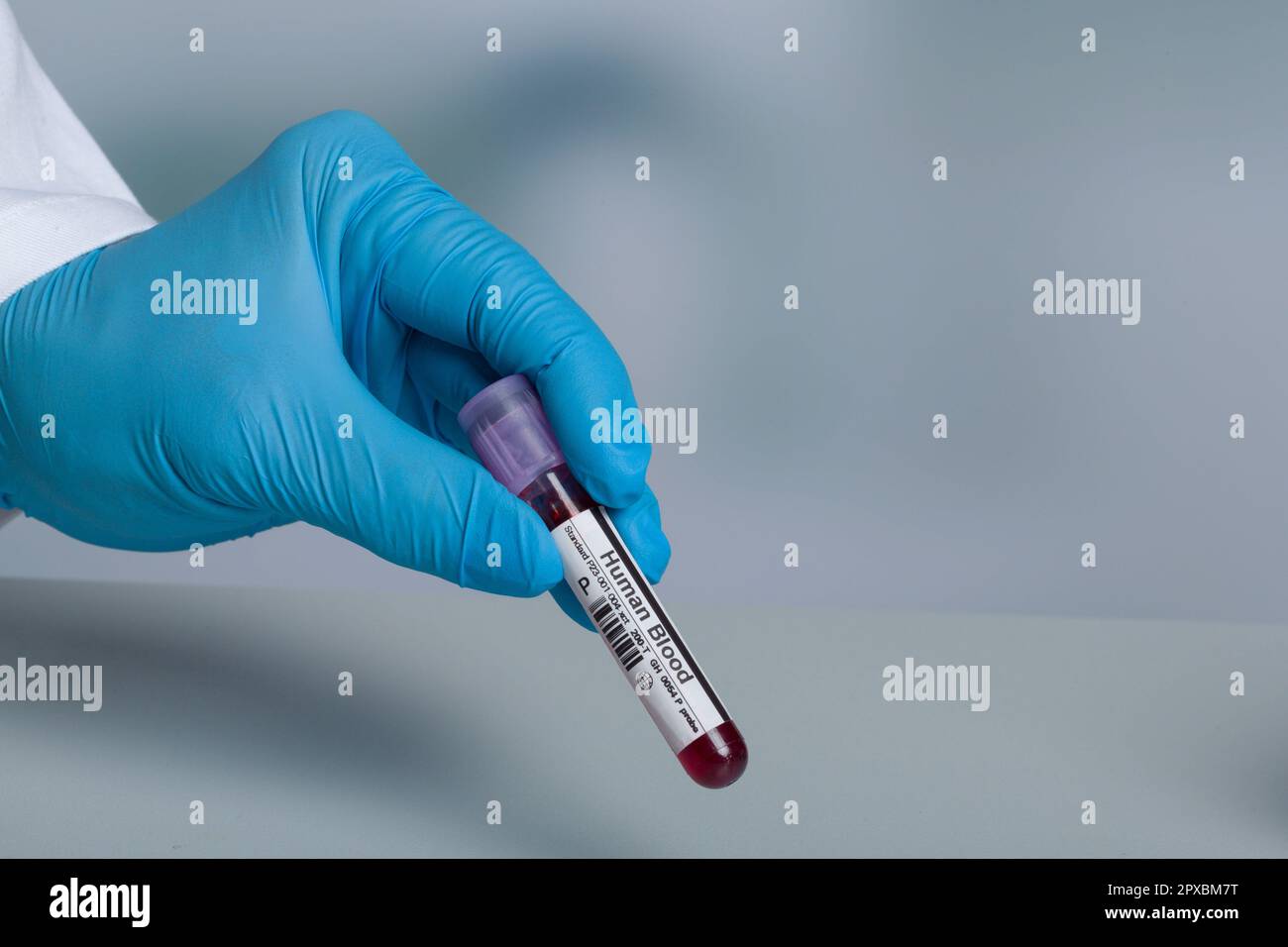 hand in medical gloves is handling a blood probe with Covid indicator ...