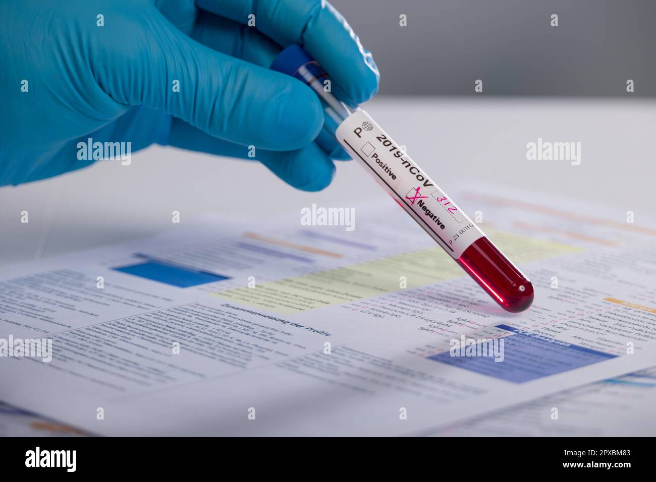 hand in medical gloves is handling a blood probe with Covid indicator ...