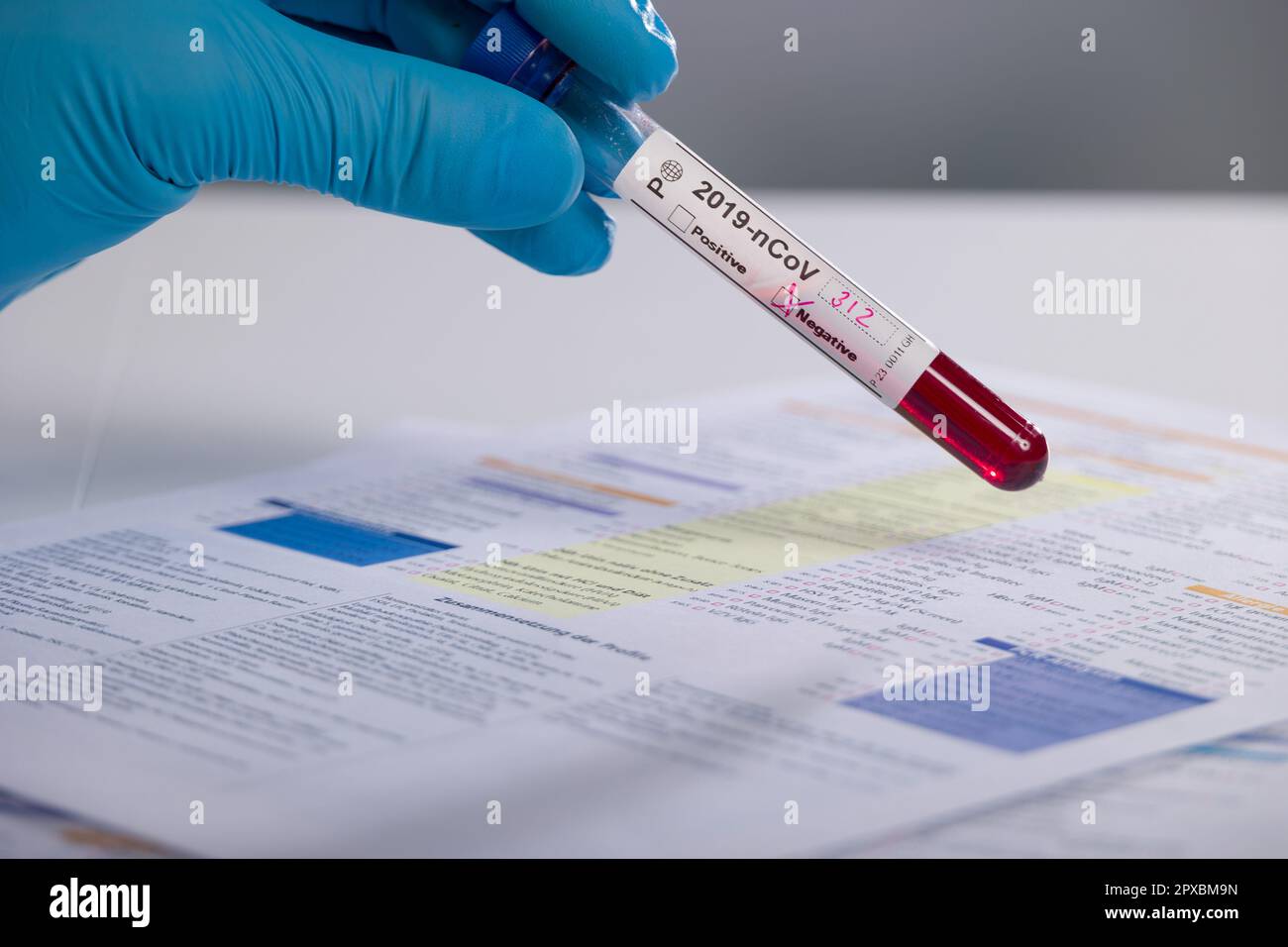 hand in medical gloves is handling a blood probe with Covid indicator ...