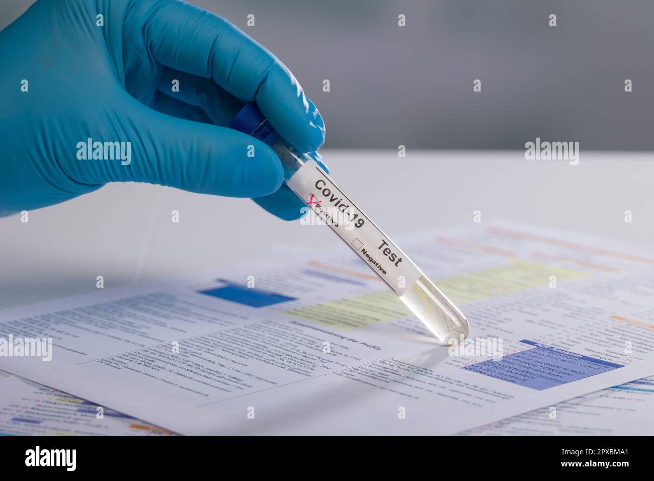 hand in medical gloves is handling a blood probe with Covid indicator ...