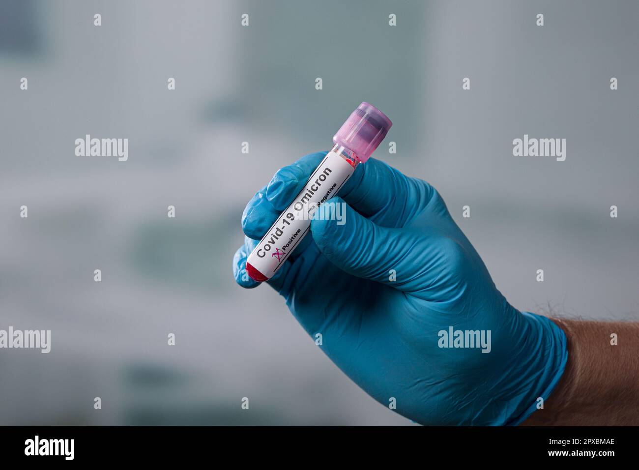hand in medical gloves is handling a blood probe with Covid indicator ...