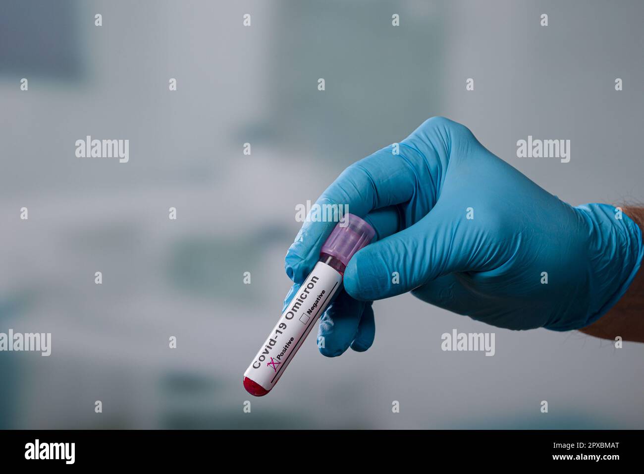 hand in medical gloves is handling a blood probe with Covid indicator ...