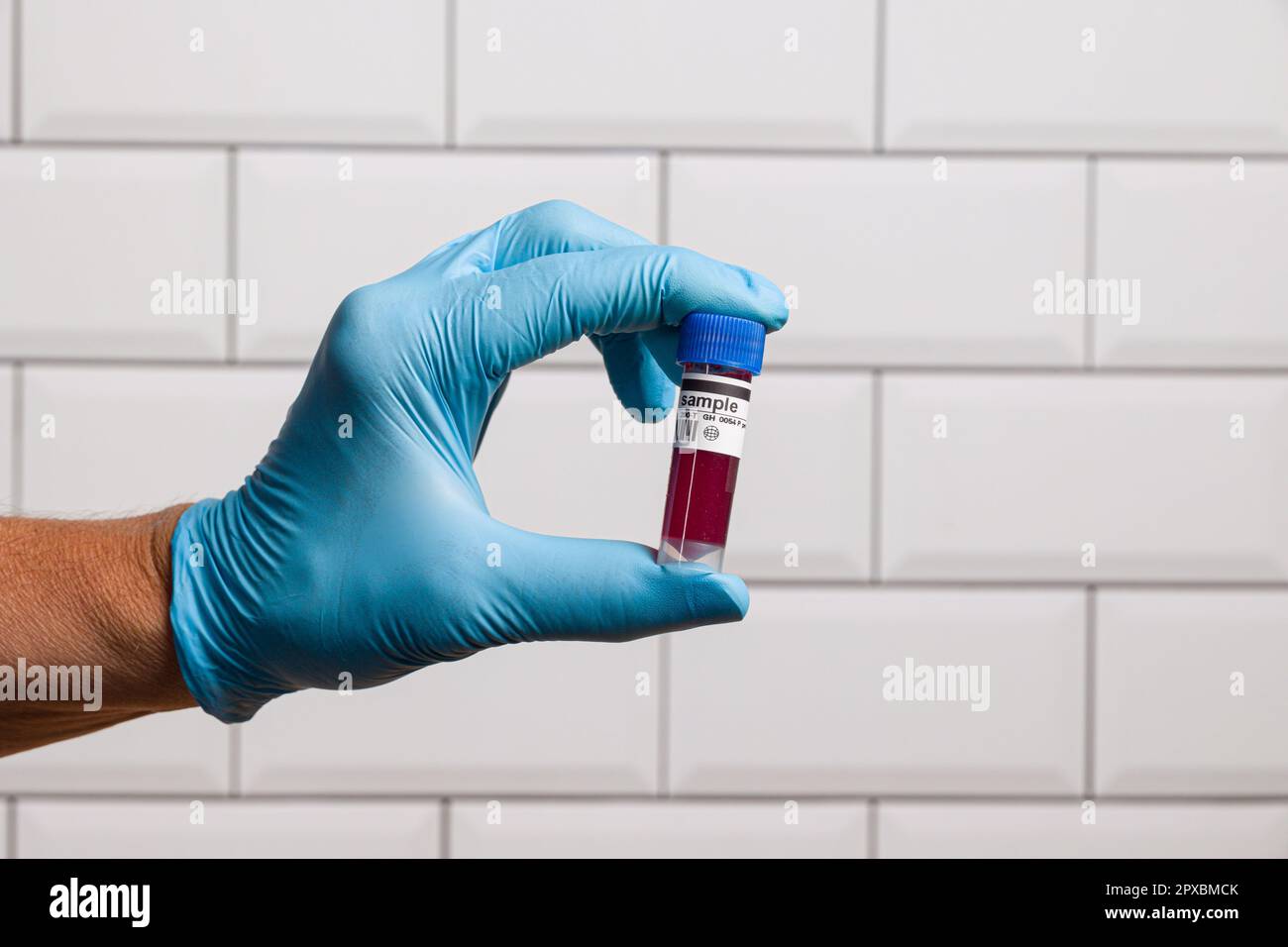 a hand in blue gloves i shandling a blood probe in a laboratory room ...