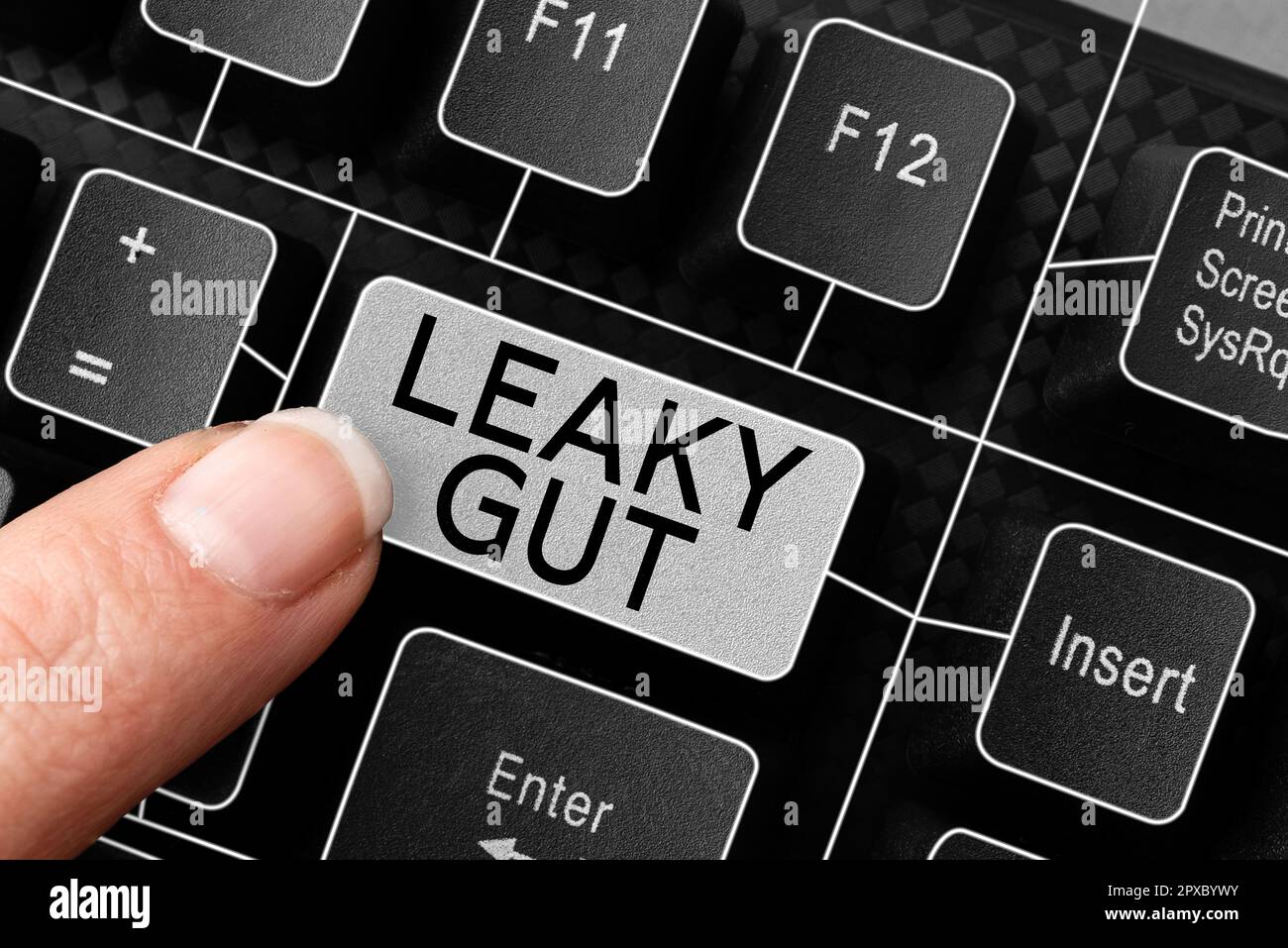 Conceptual display Leaky Gut, Concept meaning A condition in which the ... Conceptual display Leaky Gut, Concept meaning A condition in which the ...
