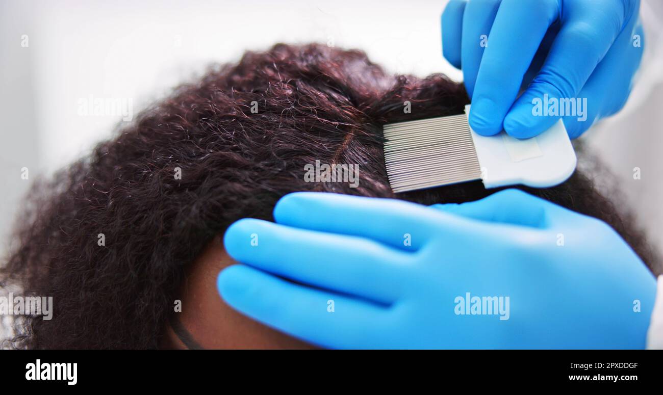 Scalp Treatment From Psoriasis And Dandruff. Dermatologist Doctor Stock ...