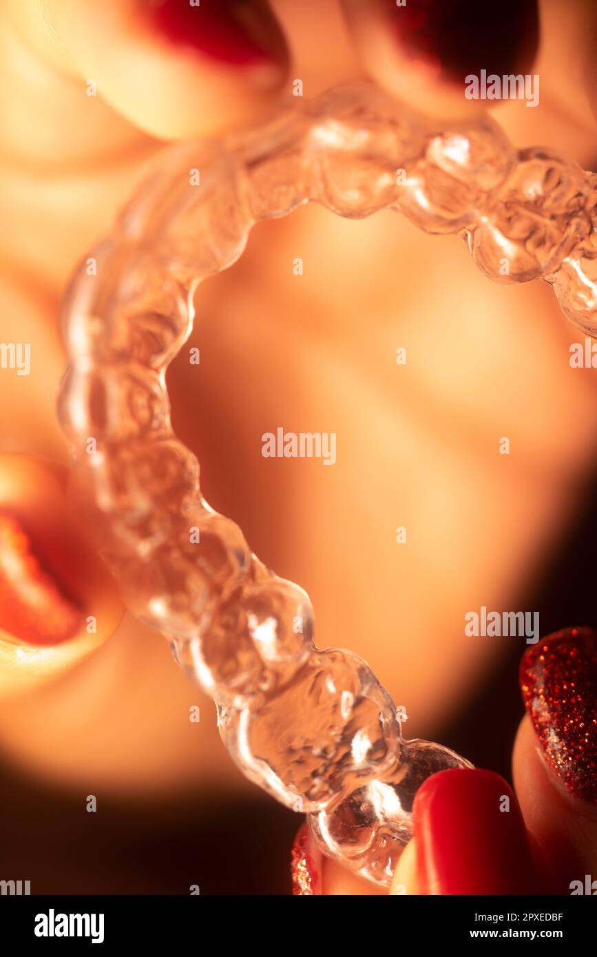 Invisible dental tooth bracket aligners to straighten teeth Stock Photo ...