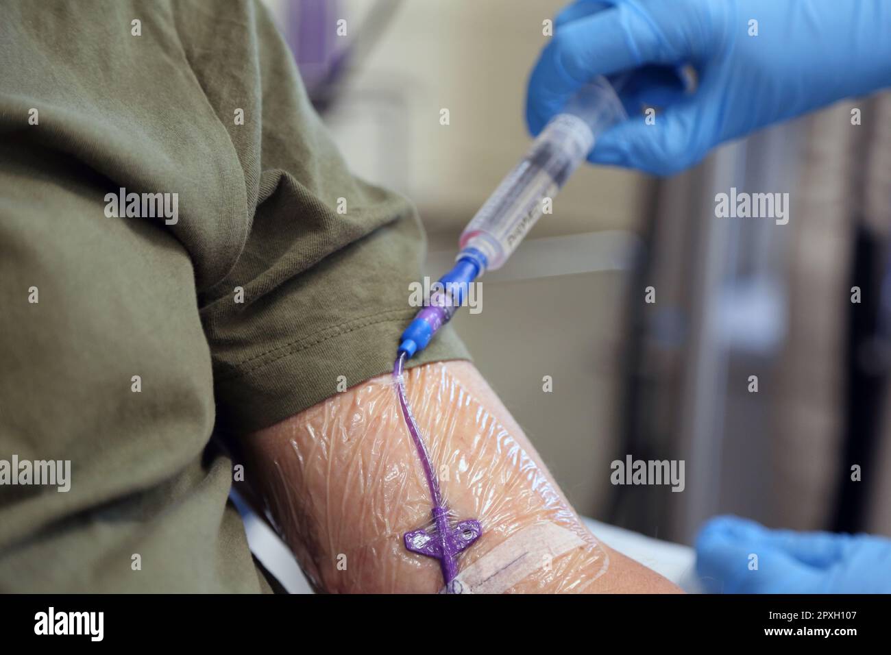 Solution Saline Flush For Flushing Out The Picc Line Peripherally Inserted Central Catheter