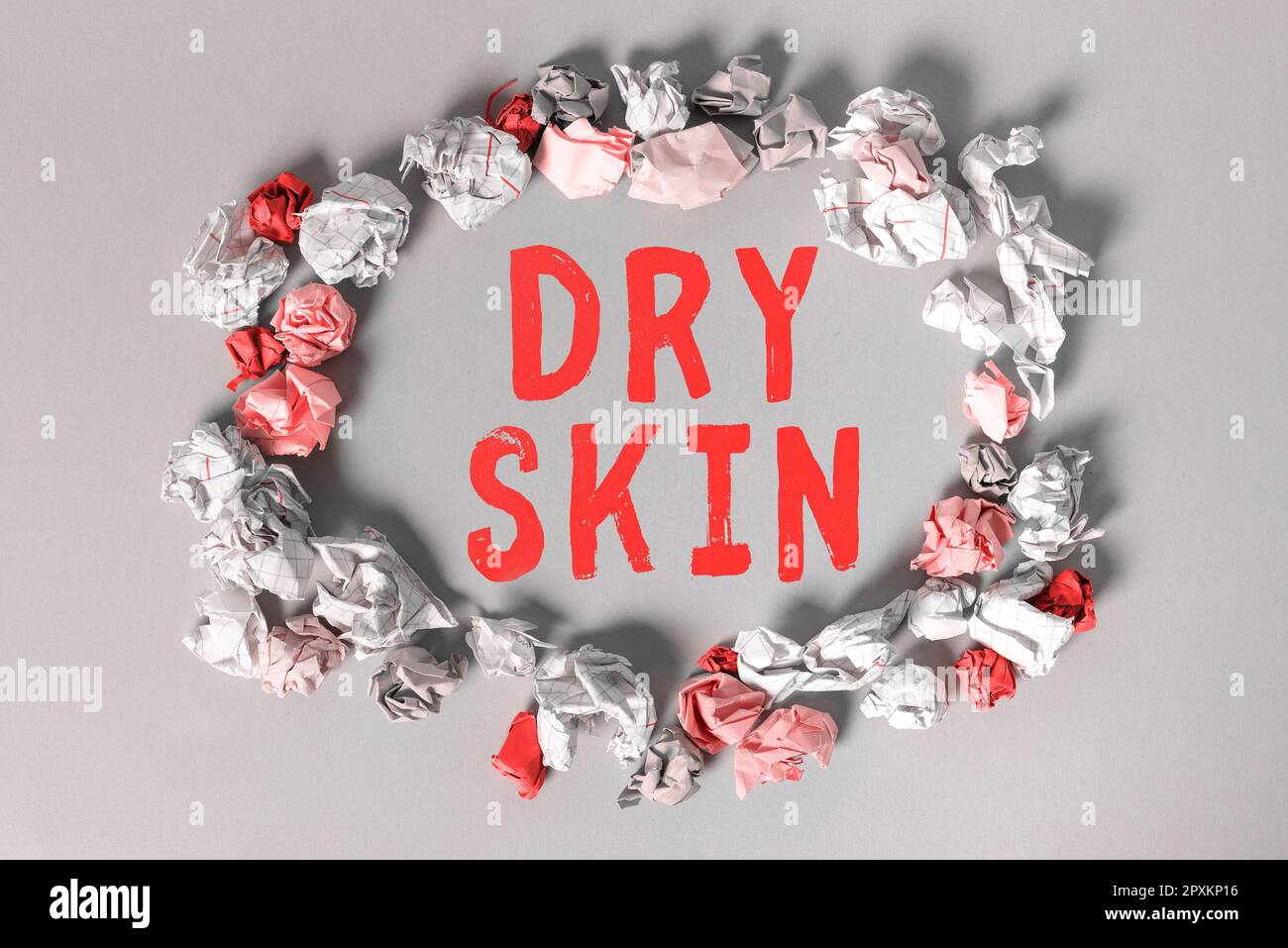 Writing displaying text Dry Skin, Concept meaning uncomfortable ...