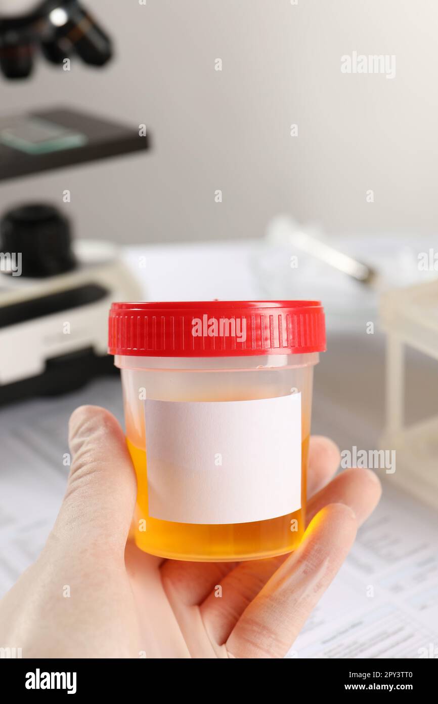 Nurse holding container with urine sample for analysis in laboratory ...