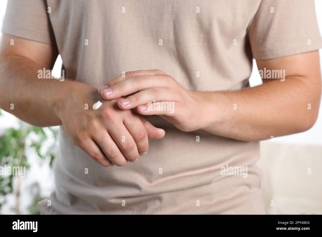Man applying salve hi-res stock photography and images - Alamy