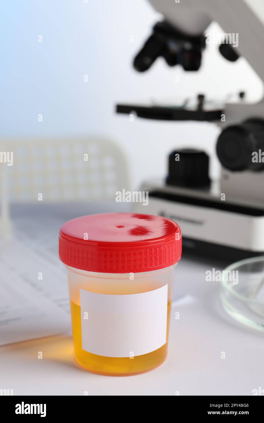 Container with urine sample for analysis on white table in laboratory ...