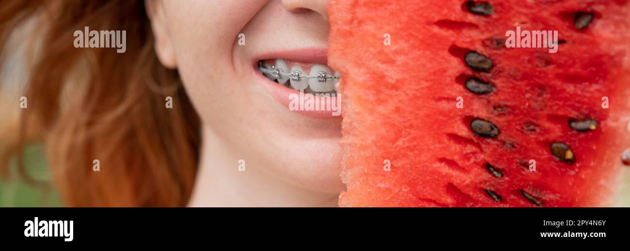 Beautiful red-haired woman smiling with braces on her teeth covers half ...