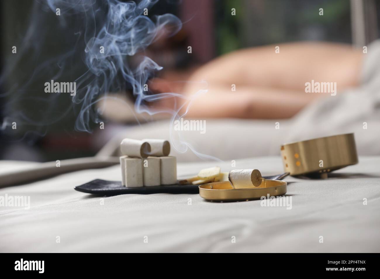 Moxibustion treatment - traditional Chinese medicine tools for acupuncture points heating ...