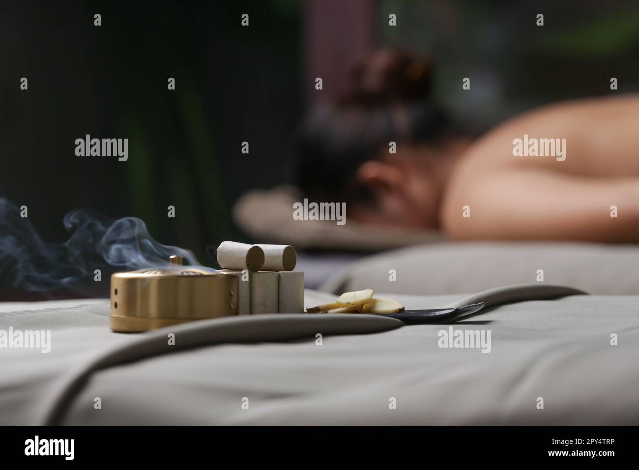 Moxibustion treatment - traditional Chinese medicine tools for acupuncture points heating ...