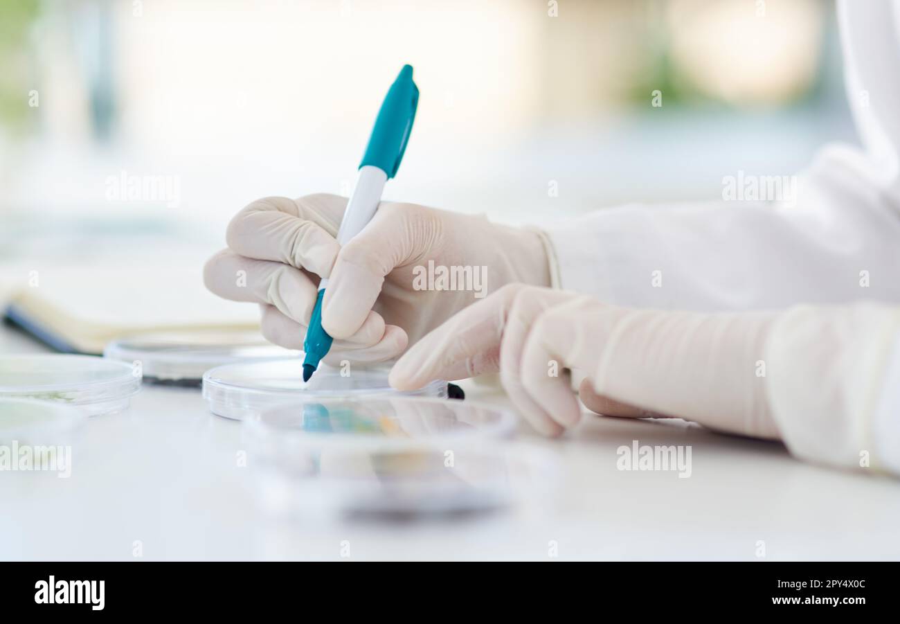 Marking each dish for easier identification. Closeup shot of an ...
