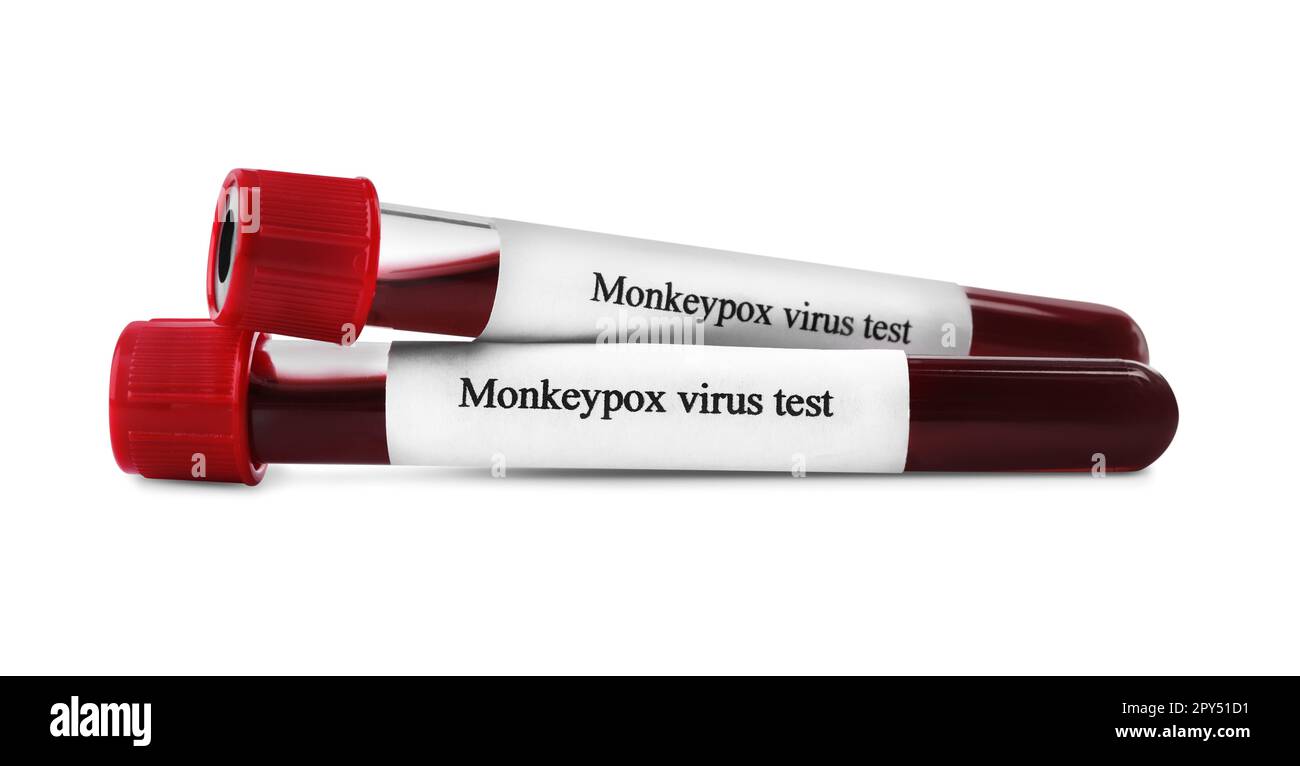 Monkeypox virus test. Sample tubes with blood on white background Stock ...