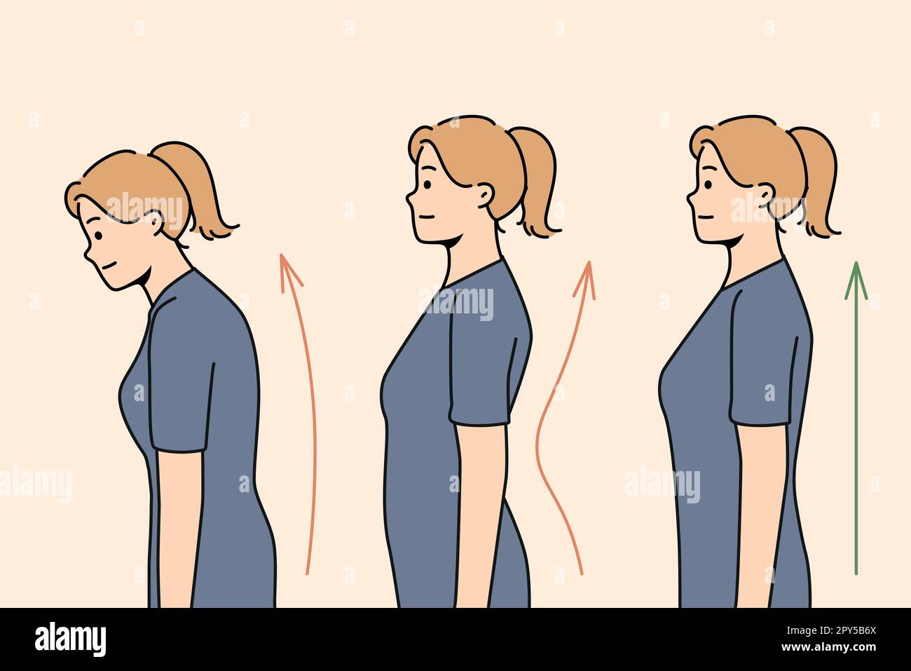 Set Of Young Woman Posture Correction Collection Of Female With And
