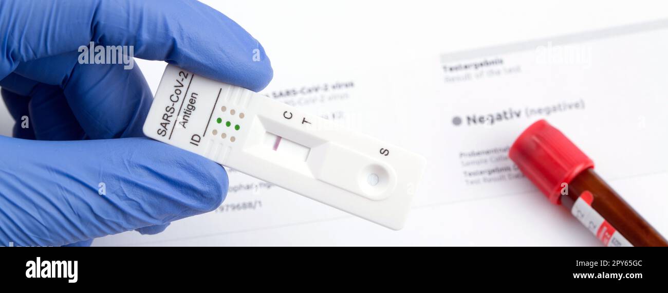 Negative test result by using rapid test device for COVID-19 Stock ...