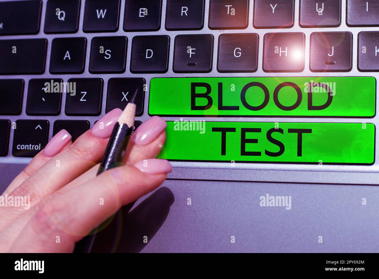Text caption presenting Blood Test. Word for Extracted blood sample ...