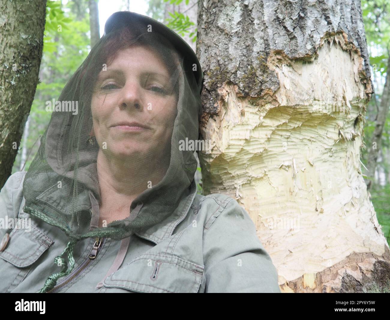 Mosquito bite face hi-res stock photography and images - Alamy